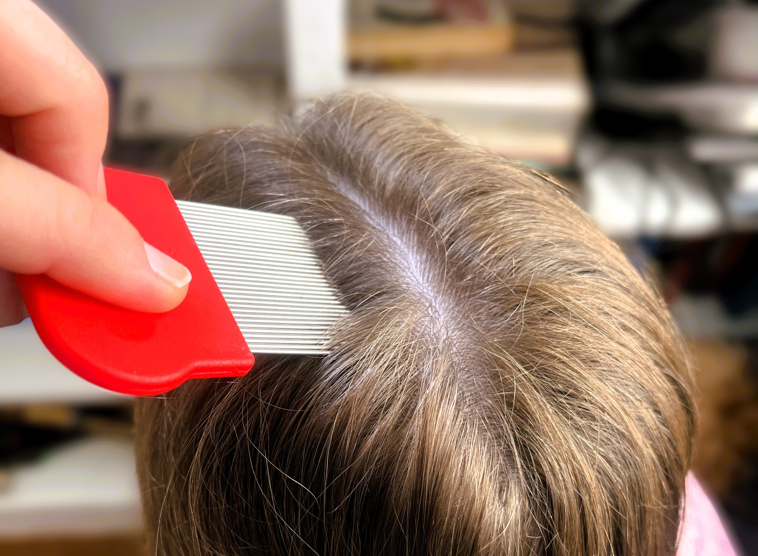 Drug-Resistant 'Super Lice' Are Here in Northern Virginia